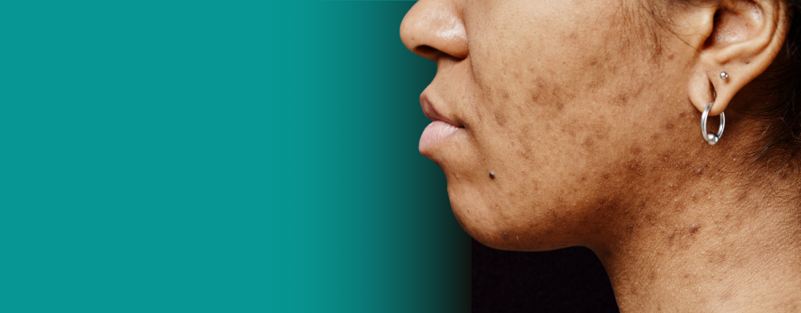 Best Silicone Scar Sheets for Face (2025) - Top Picks for Smoother ...