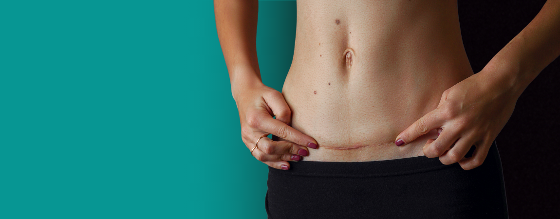 Collagen and Scar Tissue: How It Forms, Heals & What Treatments Work ...