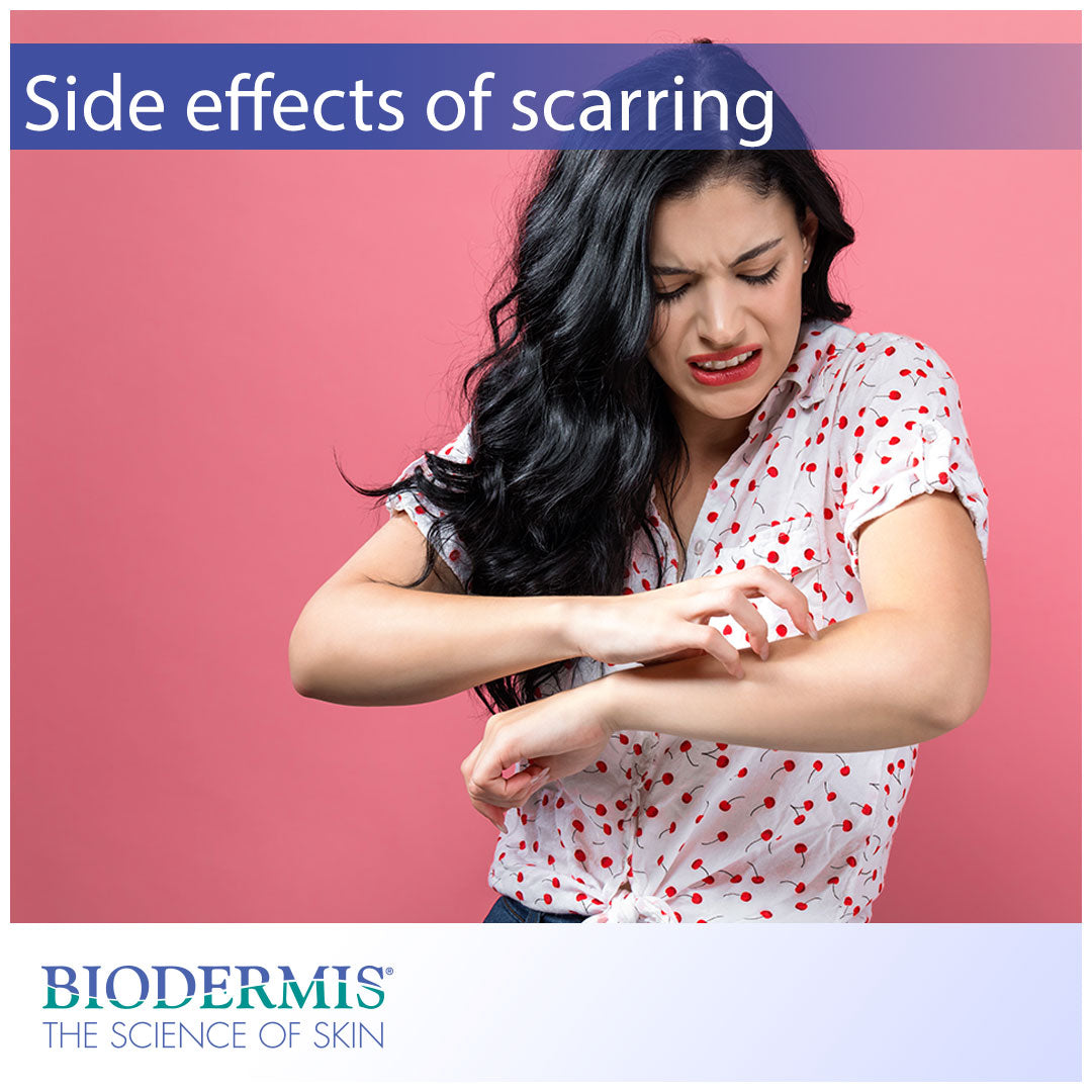 Common Side-Effects of Scarring | Biodermis.com