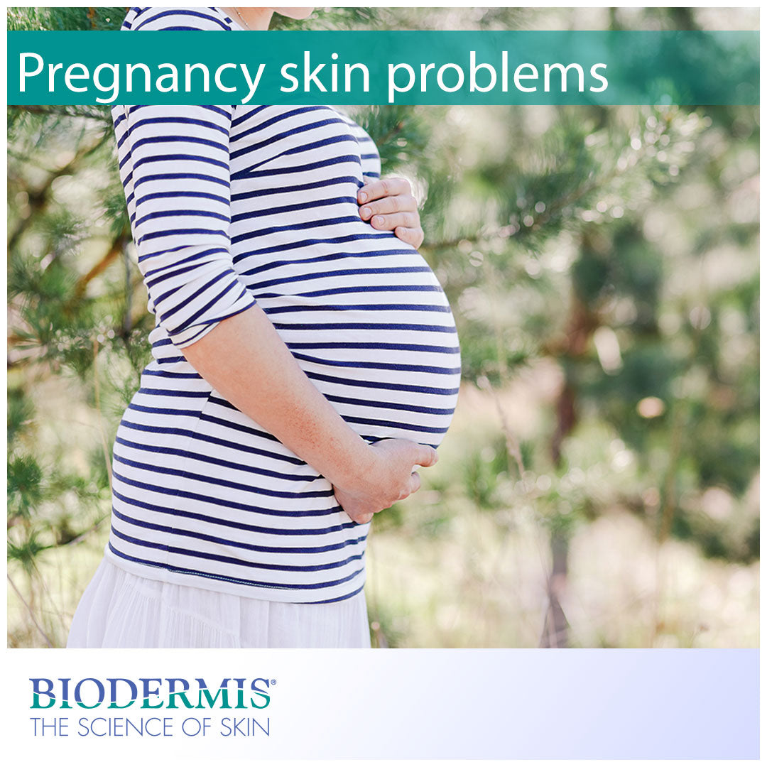 Common Skin Problems During and After Pregnancy | Biodermis.com