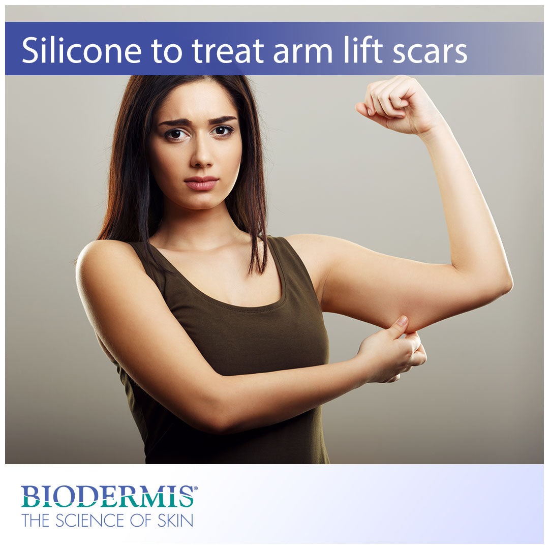 Cosmetic Surgery: How to Treat Scars after an Arm Lift | Biodermis.com