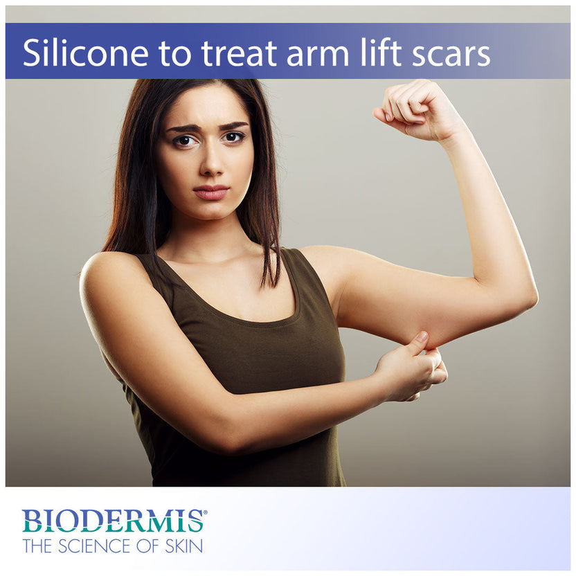 Cosmetic Surgery: How to Treat Scars after an Arm Lift | Biodermis.com