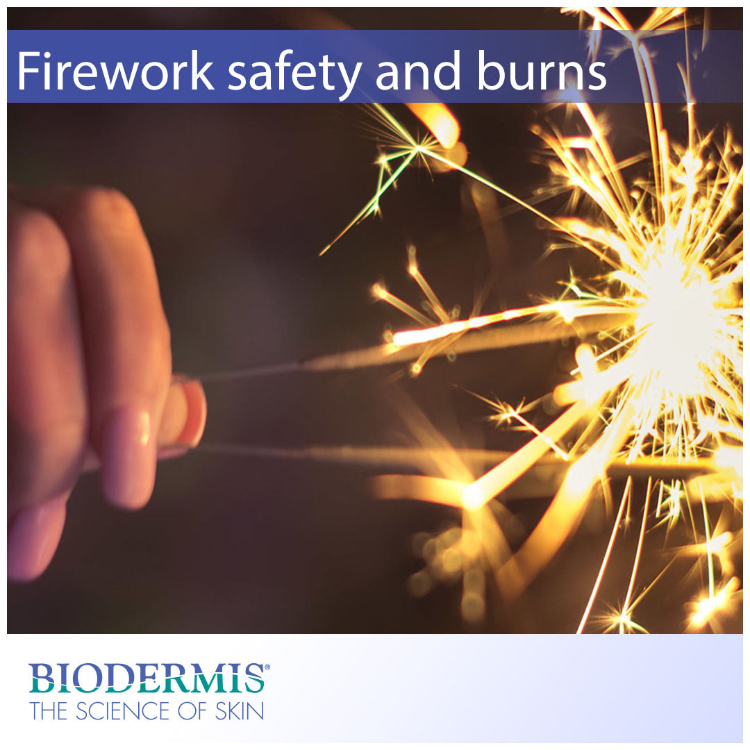 Firework Safety and Burn Treatment | Biodermis.com