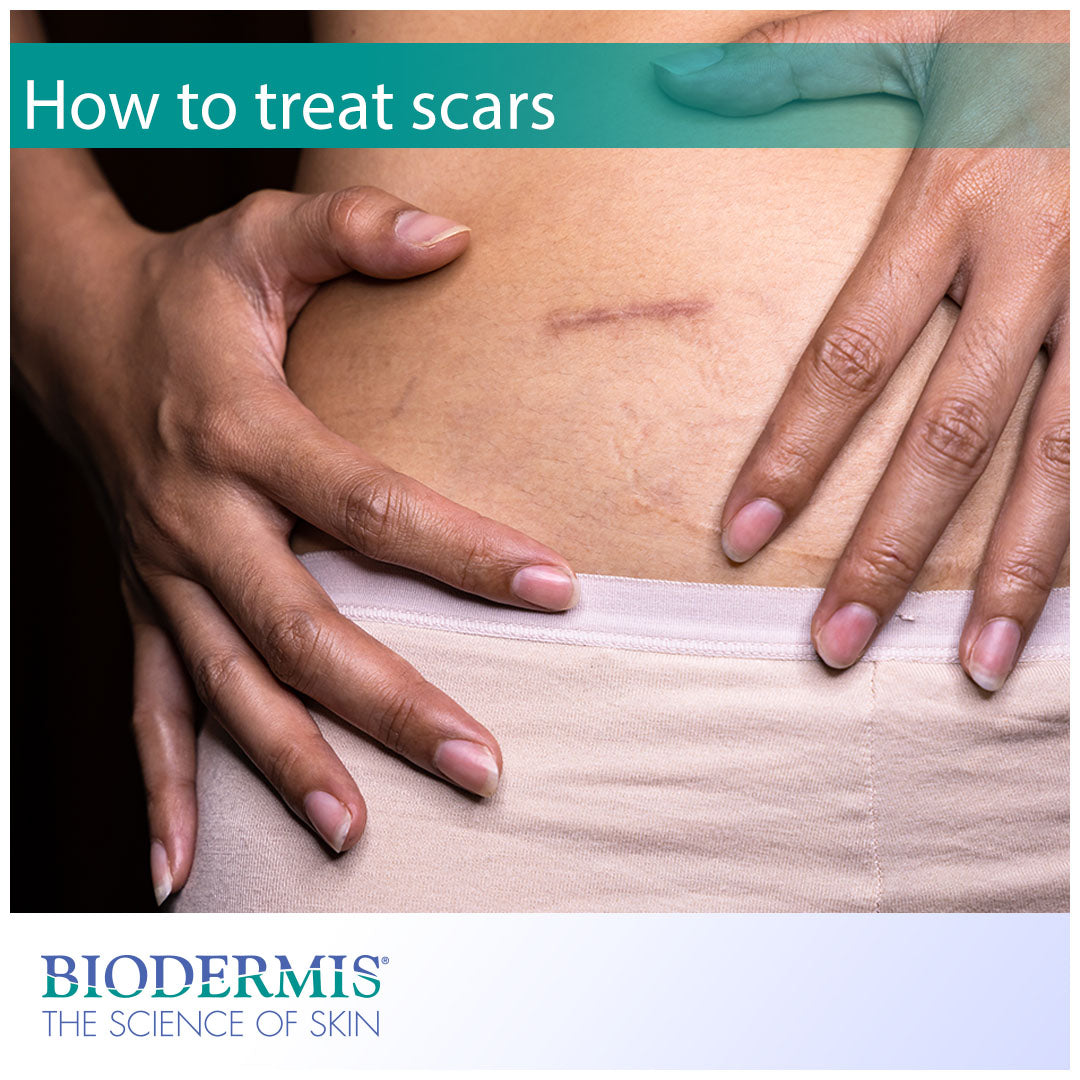How Can Scars Be Treated? | Biodermis.com