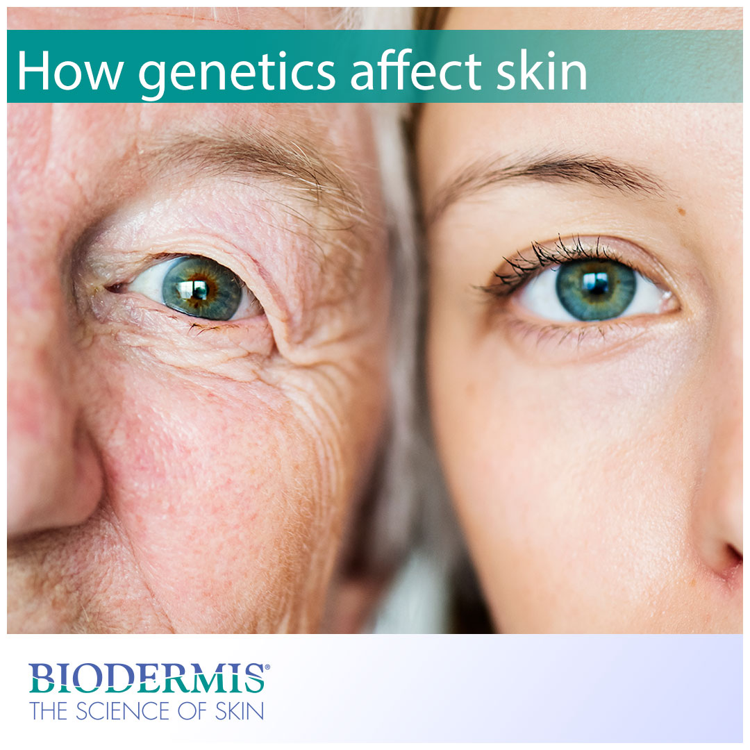 How Genetics Affects Your Skin | Biodermis.com