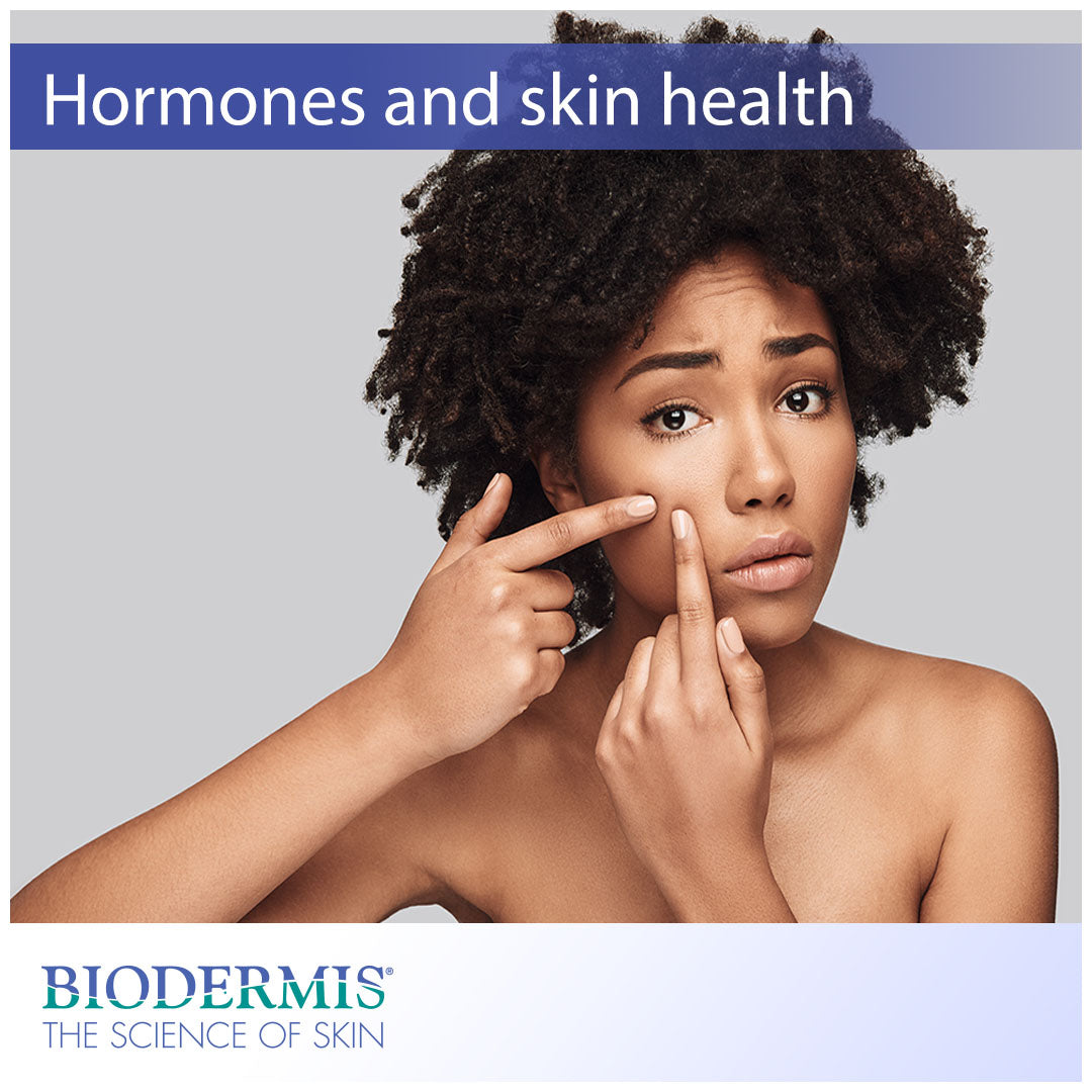 How Hormones Can Affect Skin Health | Biodermis.com