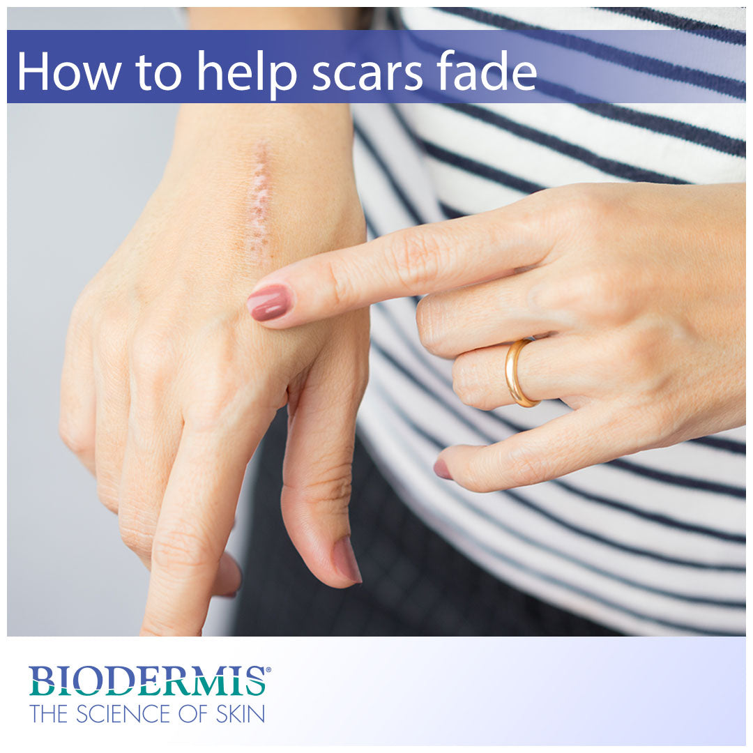 How to Help Scars Fade | Biodermis.com