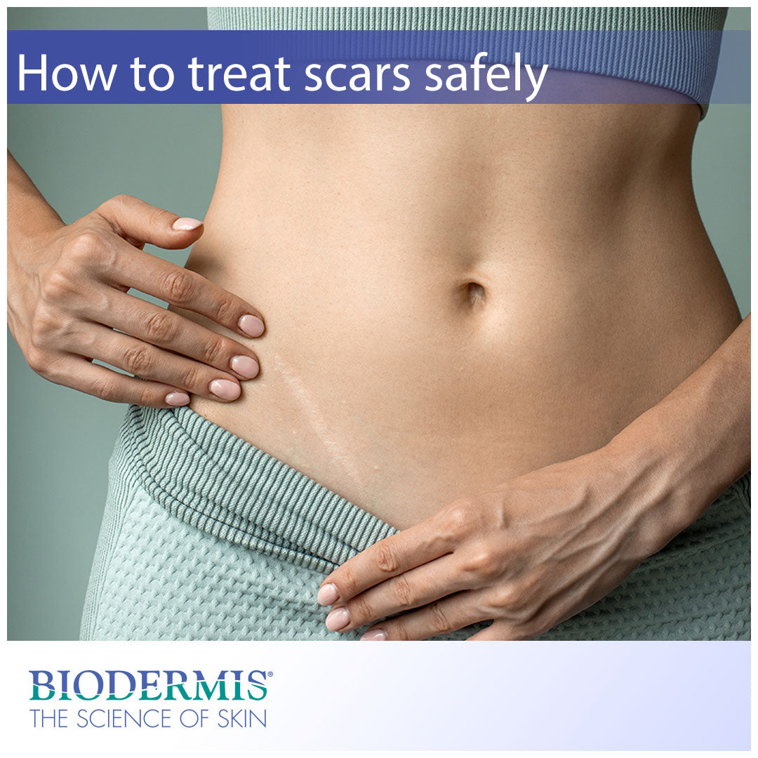 How to Treat Scars Safely | Biodermis.com