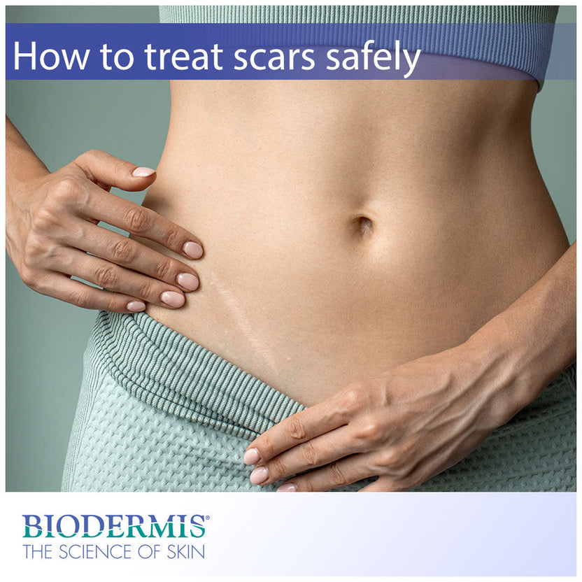 How to Treat Scars Safely | Biodermis.com