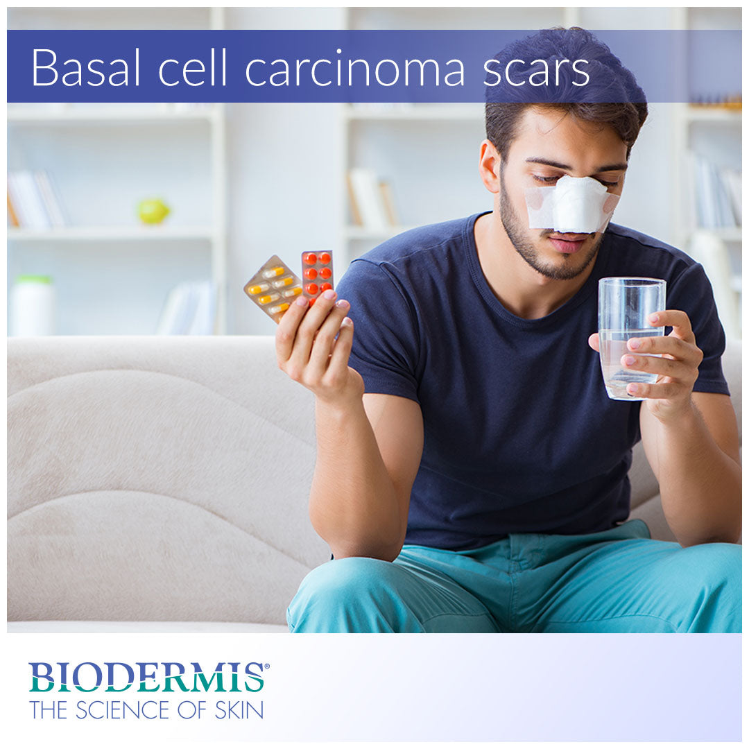 How to Treat Your Scars After Basal Cell Carcinoma | Biodermis.com