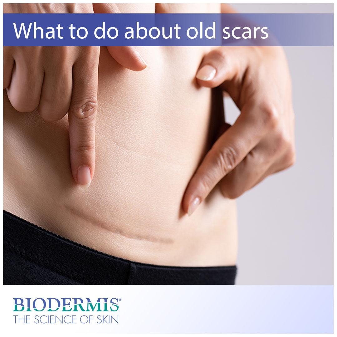 Is There Anything You Can Do About Old Scars? | Biodermis.com