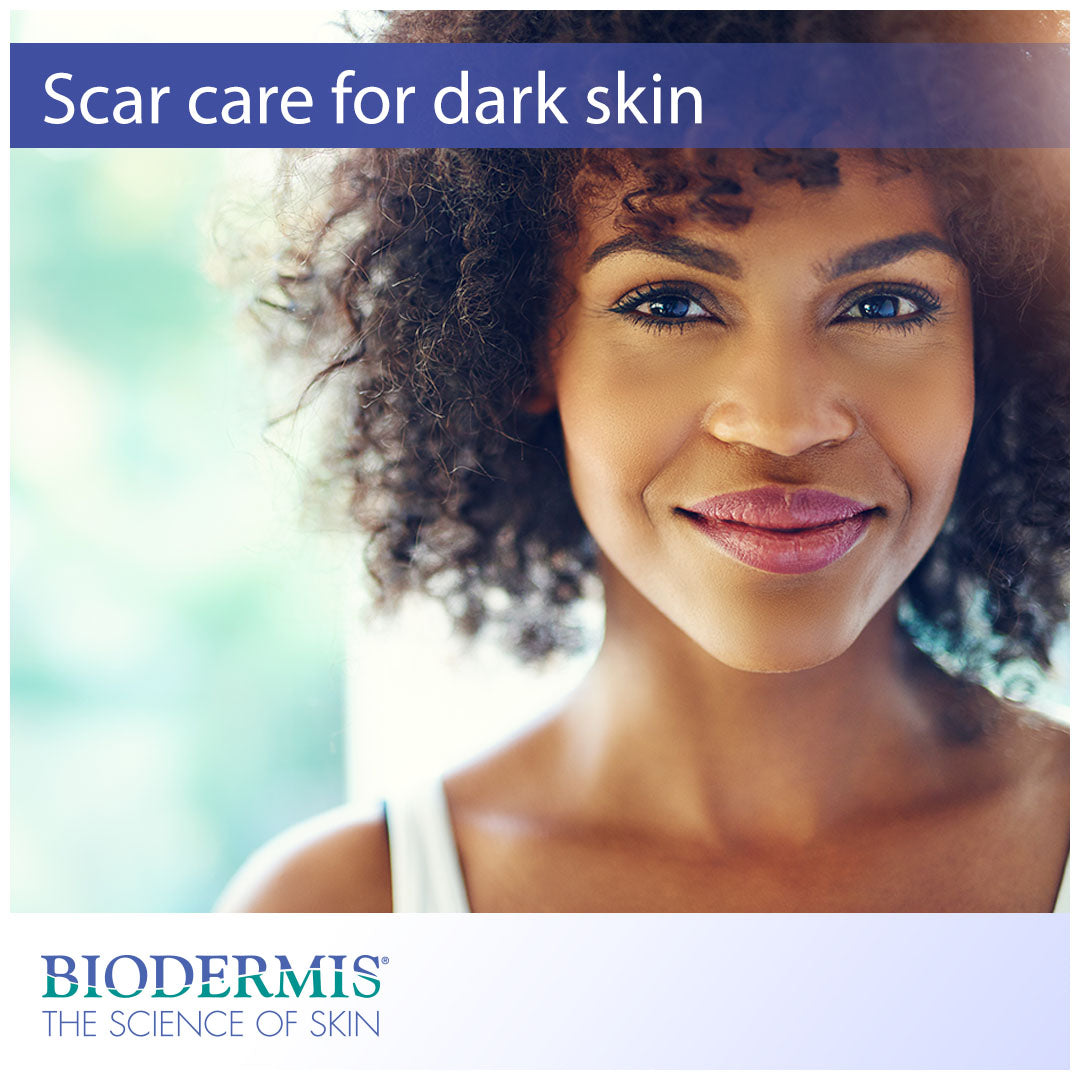 Skin Care Tips and Scar Treatment for People With Dark Skin | Biodermi ...