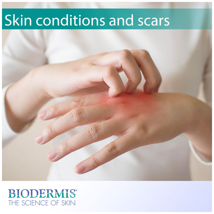 Skin Conditions That Cause Scars | Biodermis.com