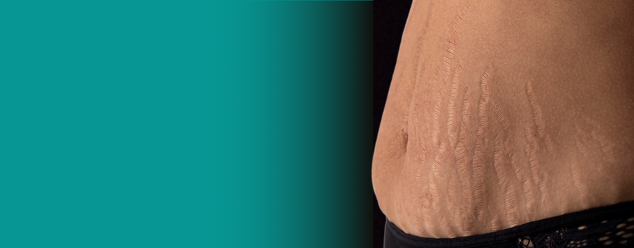 Biodermis - The Science of Skin