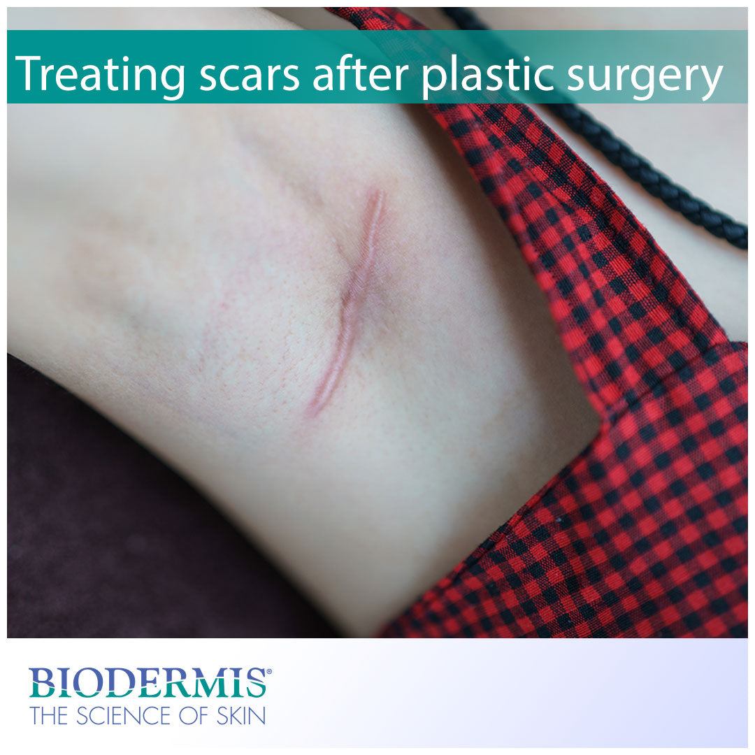 Cosmetic Surgery Scar Treatment