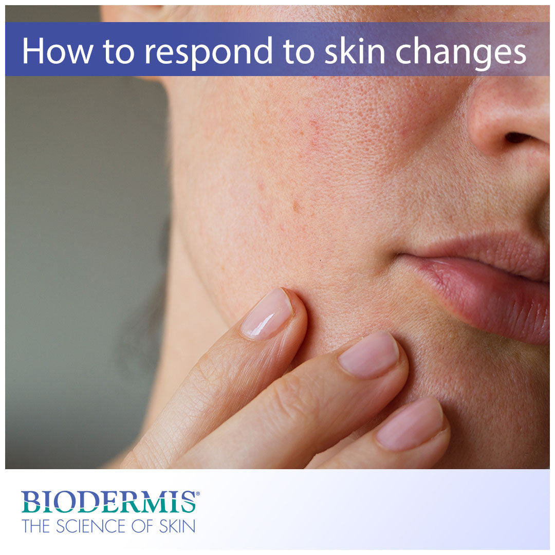 Understanding Skin Changes and How to Respond | Biodermis.com