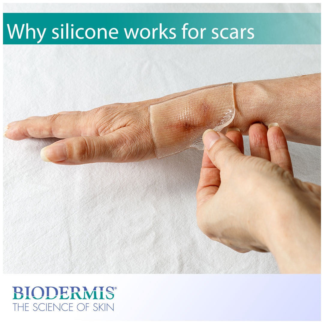What Makes Silicone Gel Good for Scar Treatment? | Biodermis.com