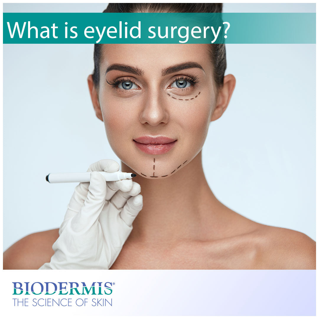 What is Eyelid Surgery? | Biodermis.com