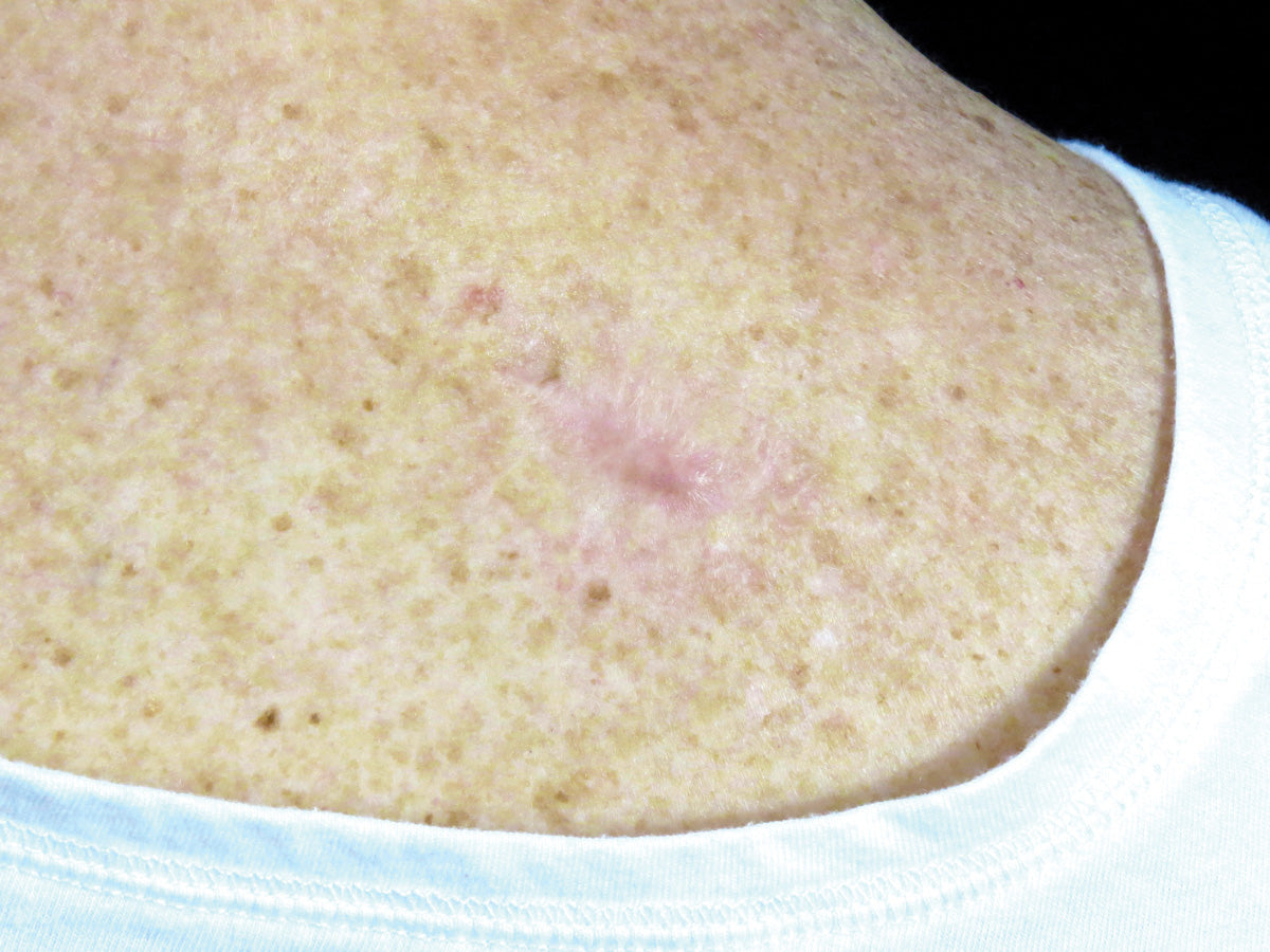 Before & After Results – Biodermis